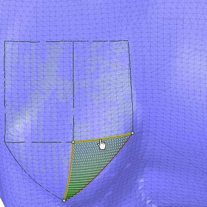 "Stitching" Surfaces Examples